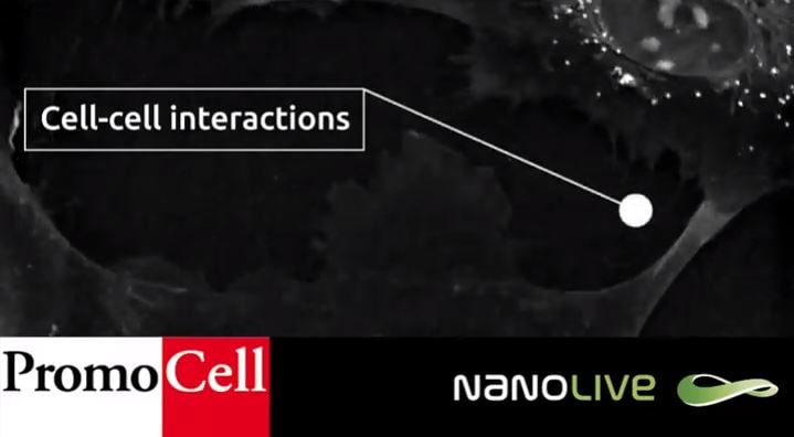 Cells in Action: membrane protrusions in HUVECs (Human Umbilical Vein ...