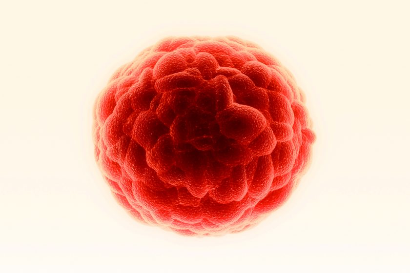 A Home for Cancer Stem Cells: 3D Tumorspheres